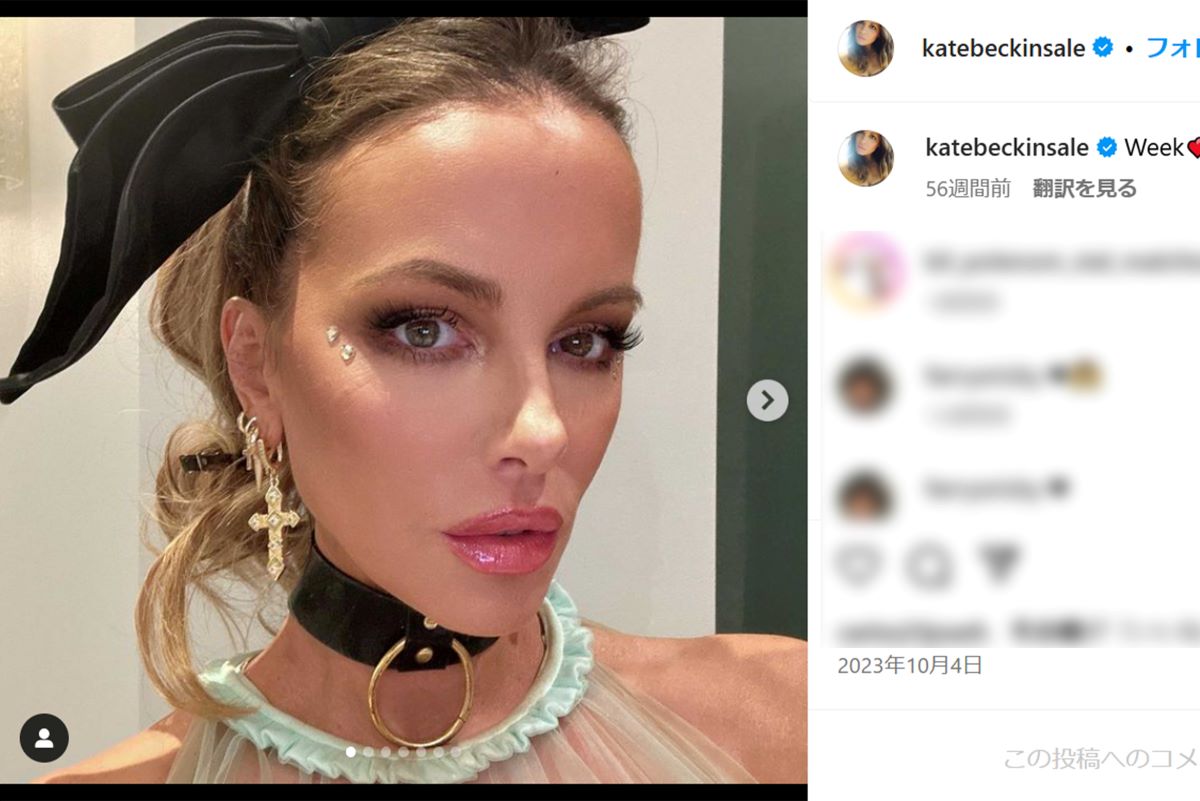 【画像・写真】ケイト・ベッキンセイル「まるで睾丸みたい」“イングランドのno 1美女”が着用したドレスへの過激表現が物議 週刊女性prime